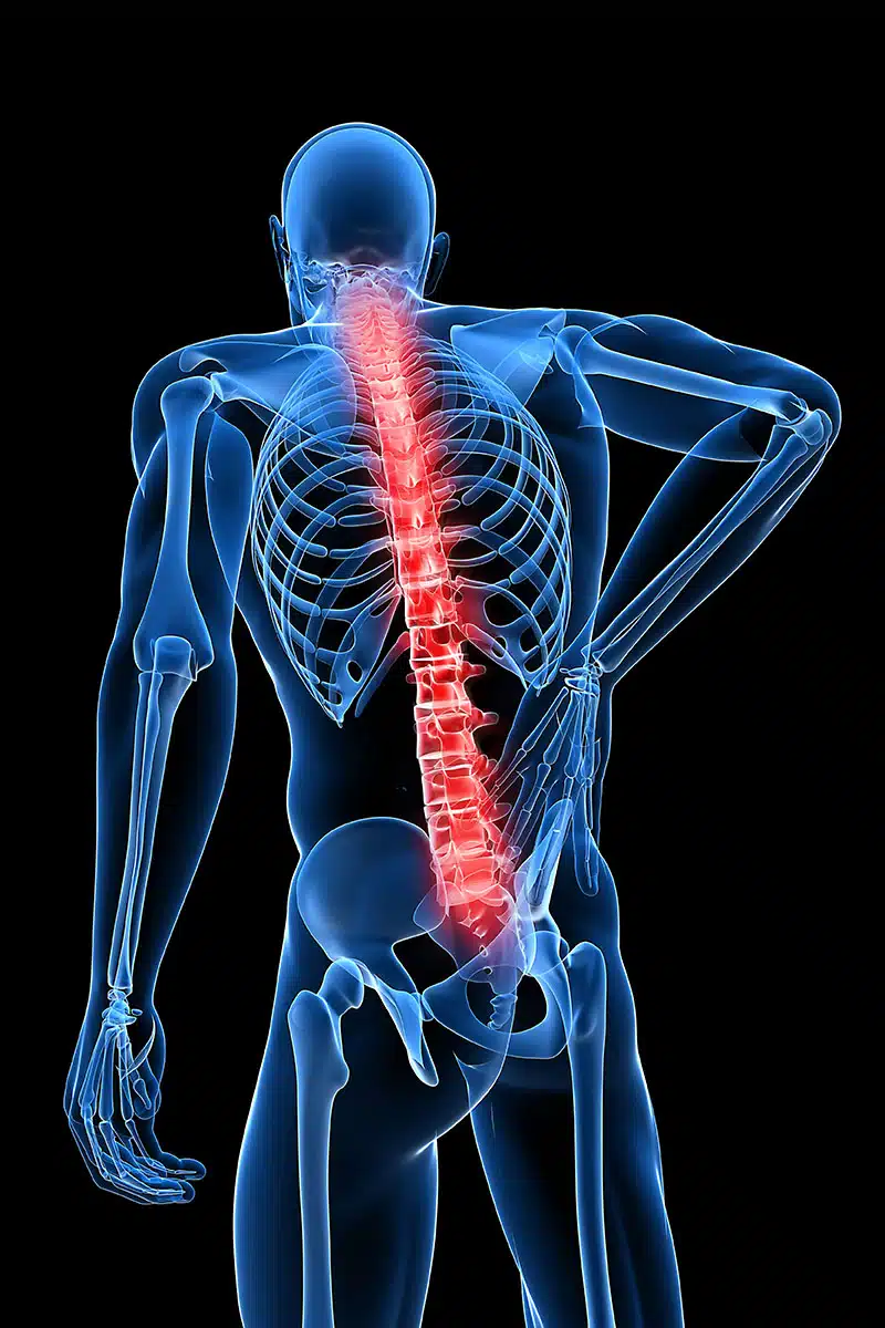 Subluxation Treatment | Chiropractic Health Clinic Omaha